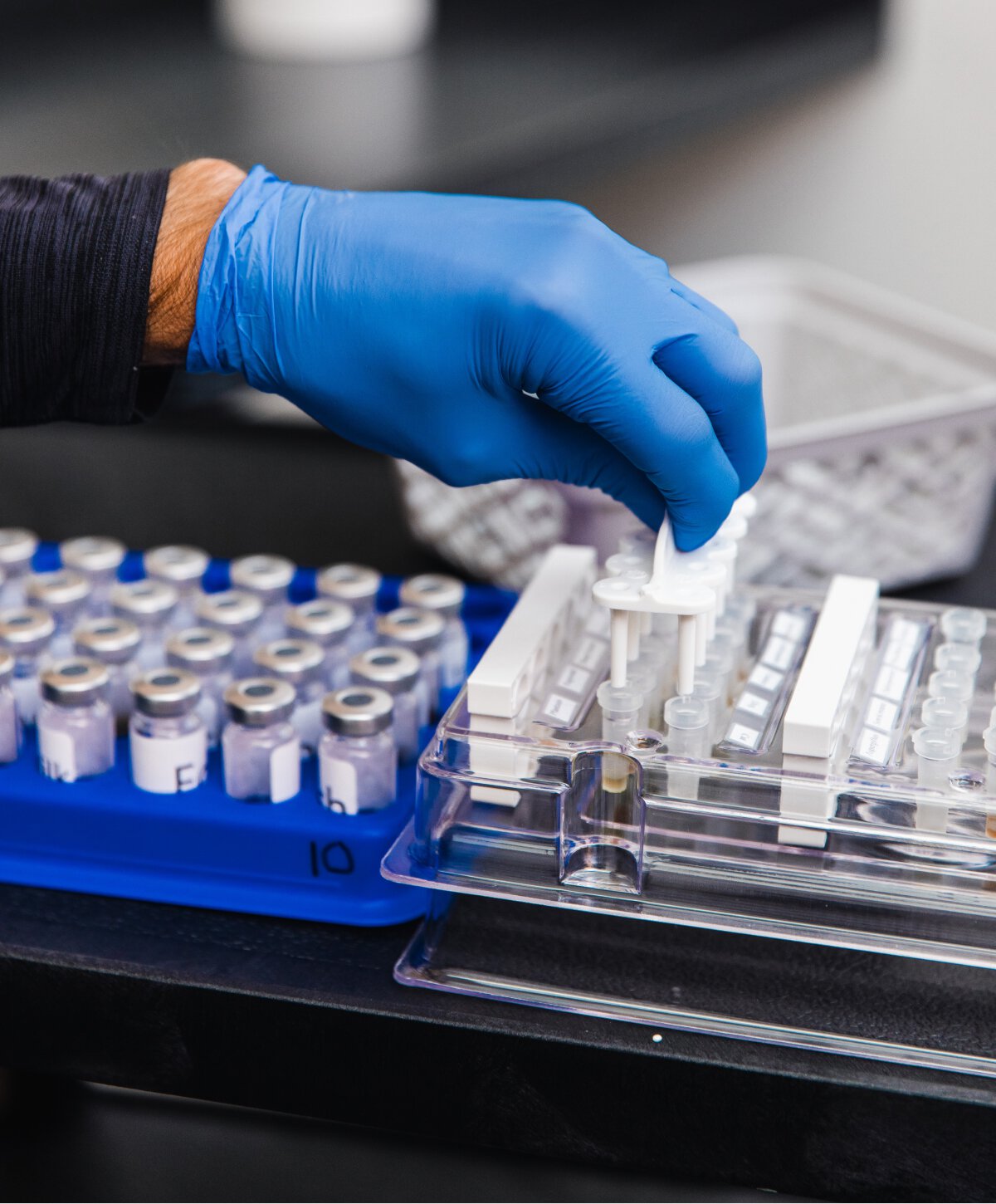 Allergy Testing Novi | Immunology | ENT Specialists